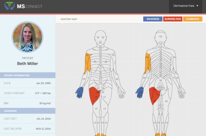 MS Connect- A Better Future for Multiple Sclerosis | Indiegogo