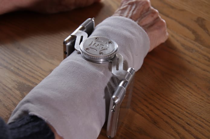 Tremelo - hand stabilizer for Essential Tremor | Indiegogo