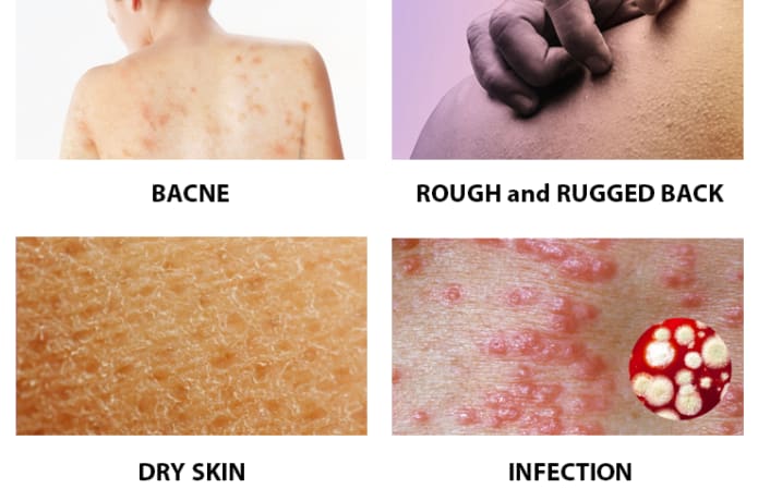 SELF BACK MASK | Indiegogo