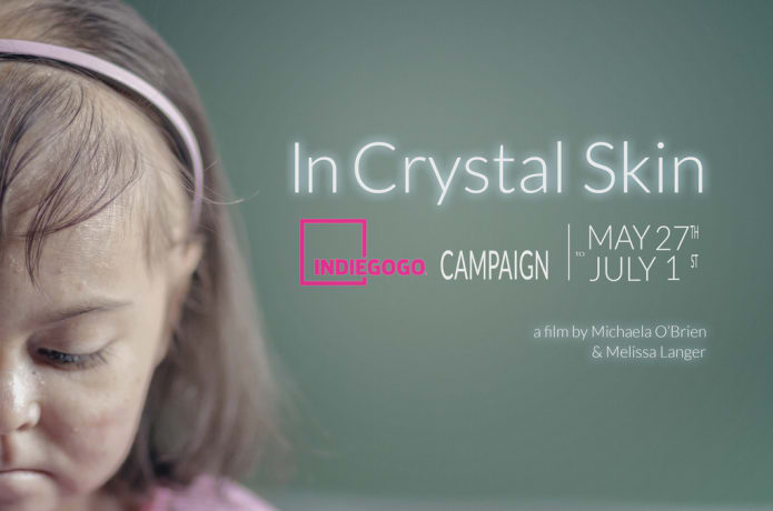 In Crystal Skin - A Documentary Film | Indiegogo